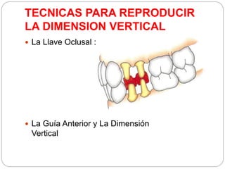 Dimensión Vertical.pptx