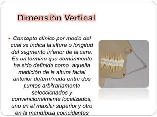 Dimensión Vertical.pptx