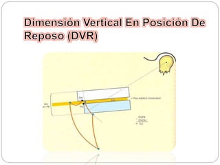 Dimensión Vertical.pptx