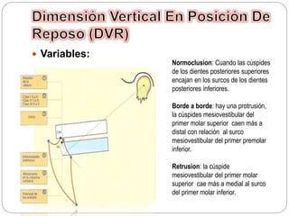 Dimensión Vertical.pptx