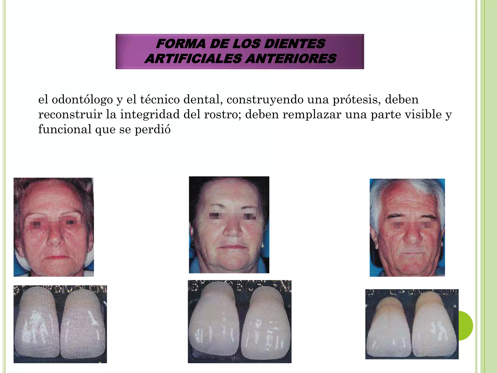 Dimension, forma y color de los dientes artificiales protesis total | PDF
