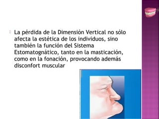 Dimension vertical oclusión | PPT