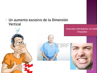 Dimension vertical oclusión | PPT
