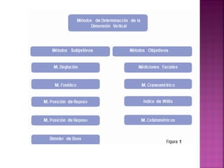 Dimension vertical oclusión | PPT