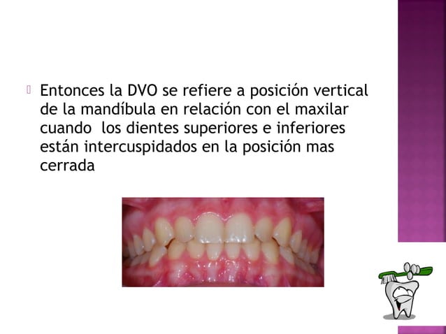 Dimension vertical oclusión | PPT