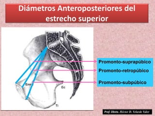 Diámetros de la Pelvis Materna | PPTX