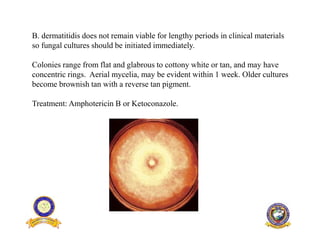 Dimorphic fungi | PDF | Infectious Diseases | Diseases and Conditions