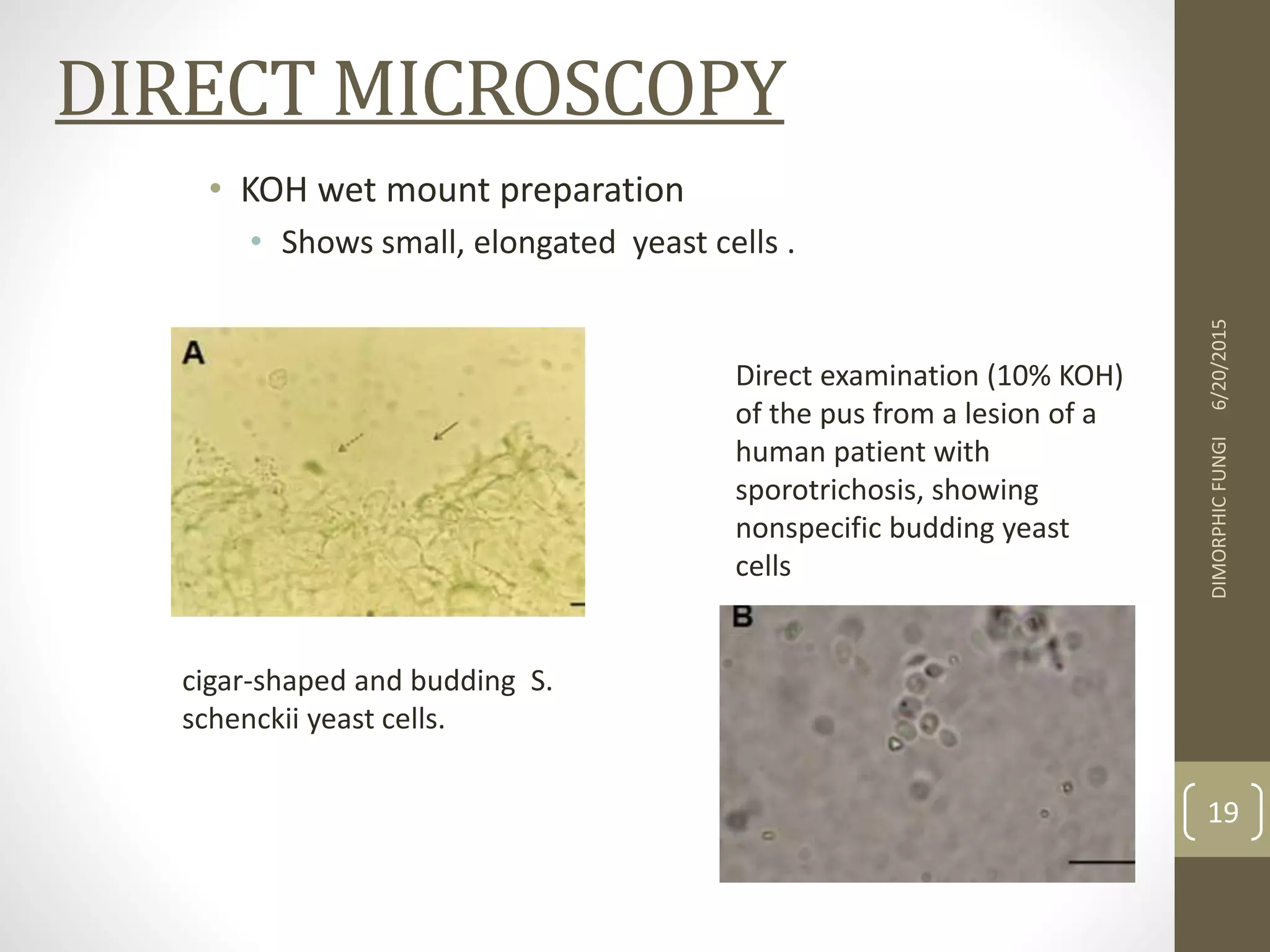 Dimorphic fungi | PPTX