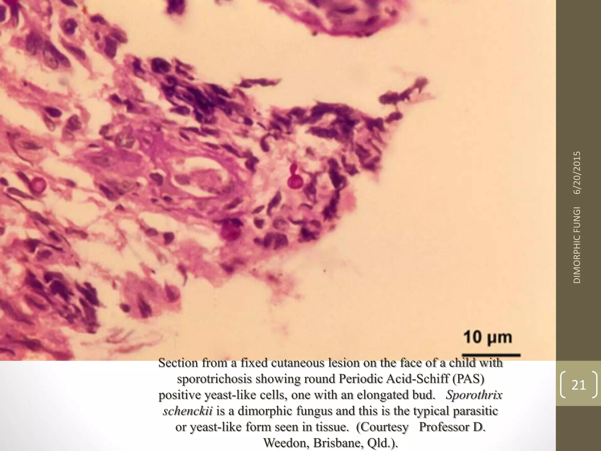 Dimorphic fungi | PPTX