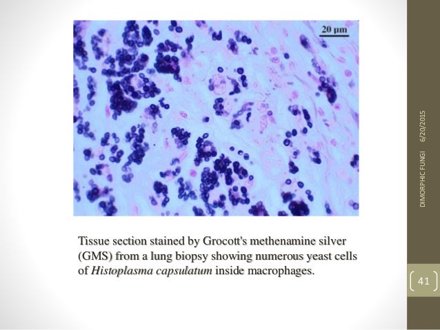 Dimorphic Fungi Dimorphic Fungal Pathogens. * | Download Table