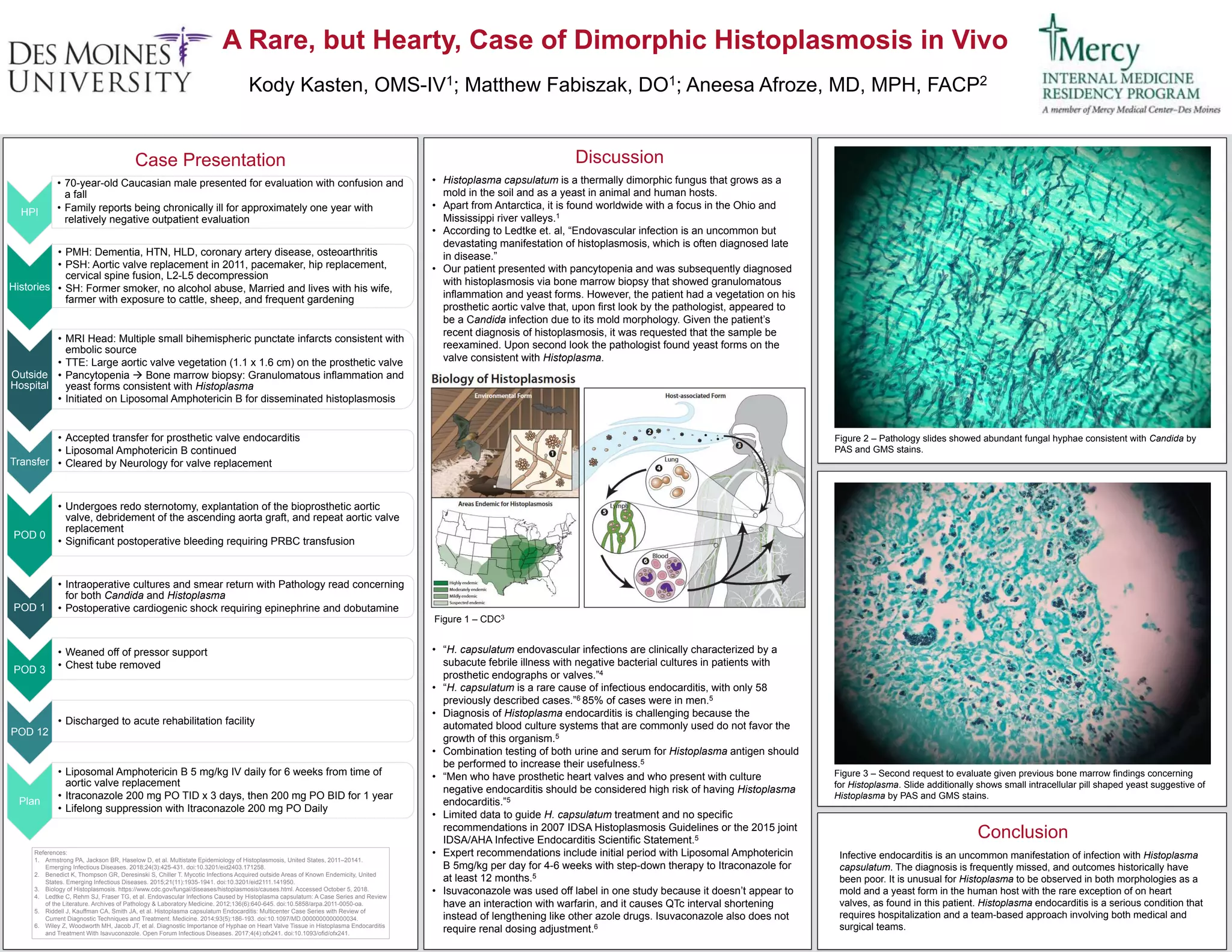 Case of Dimorphic Histoplasmosis in Vivo | PPTX