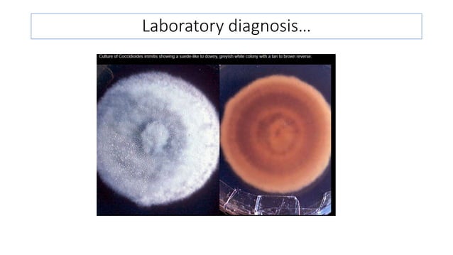 Dimorphic Systemic Mycoses.pptx
