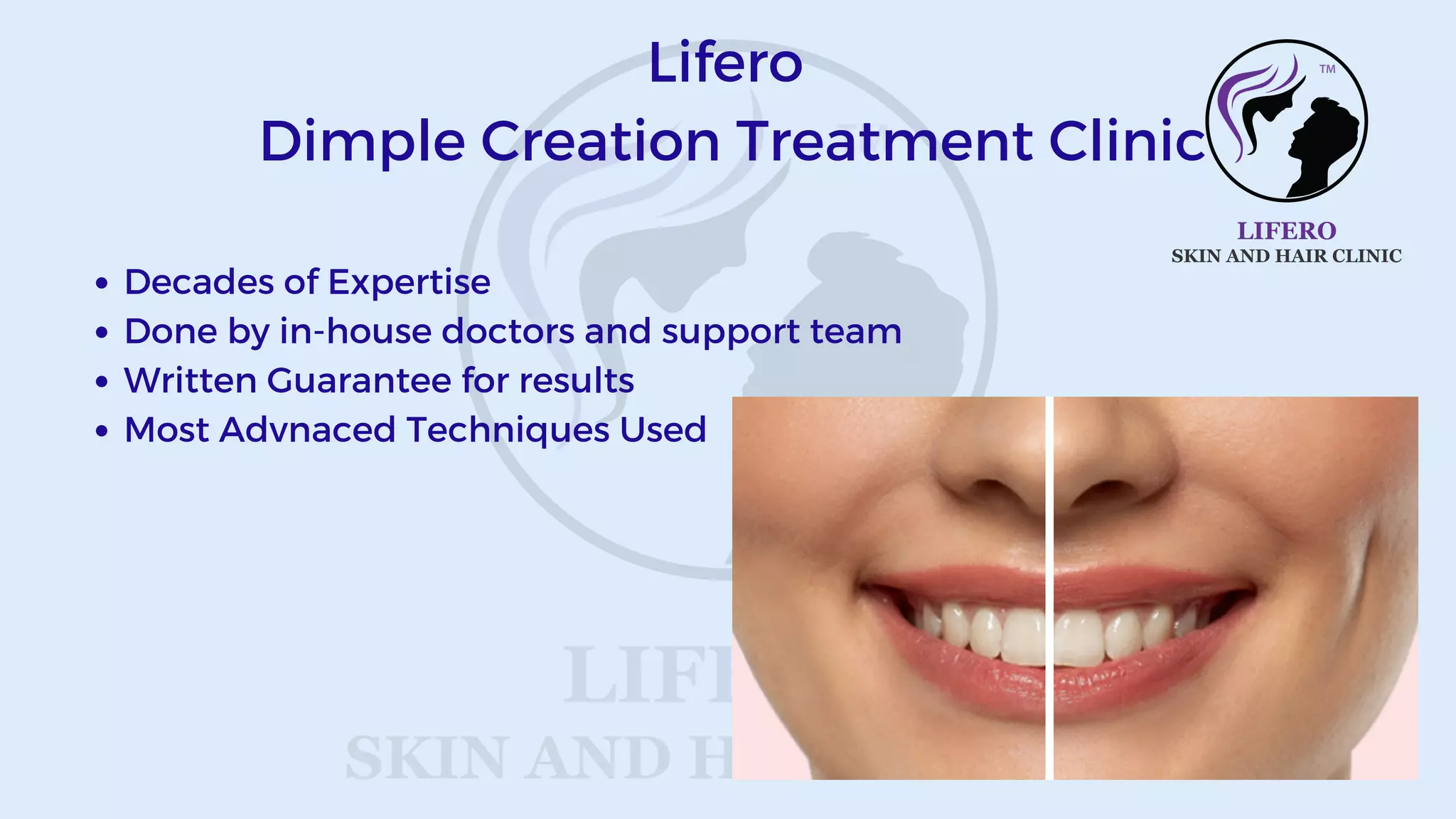 Dimple Creation Treatment.pdf