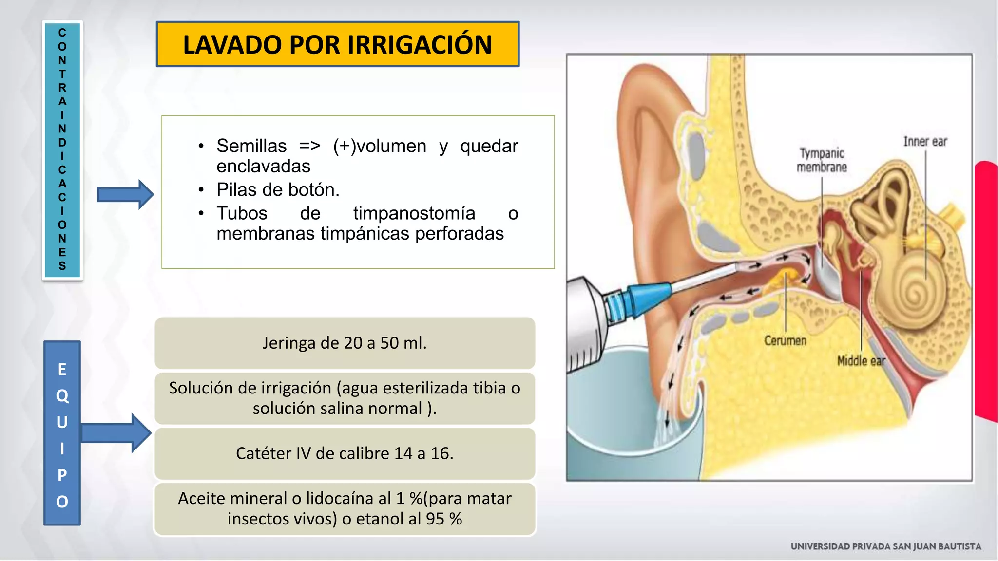 DINAMICA ANTOMICA CUERPO EXTRAÑO Y TAPON DE CERUMEN.pptx