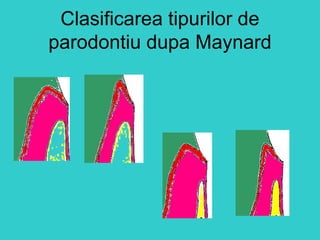 Dinamica sistemului stomatognat.ppt