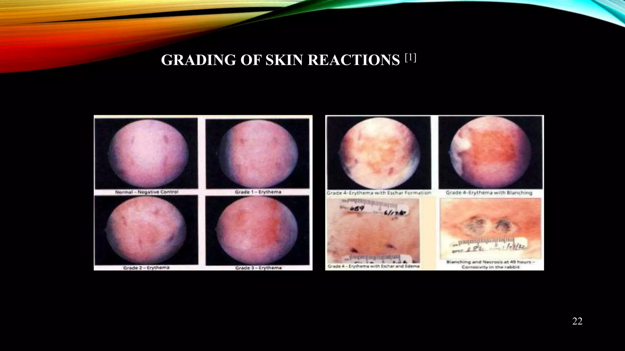 Dermal Irritation and Dermal Toxicity Studies | PPTX