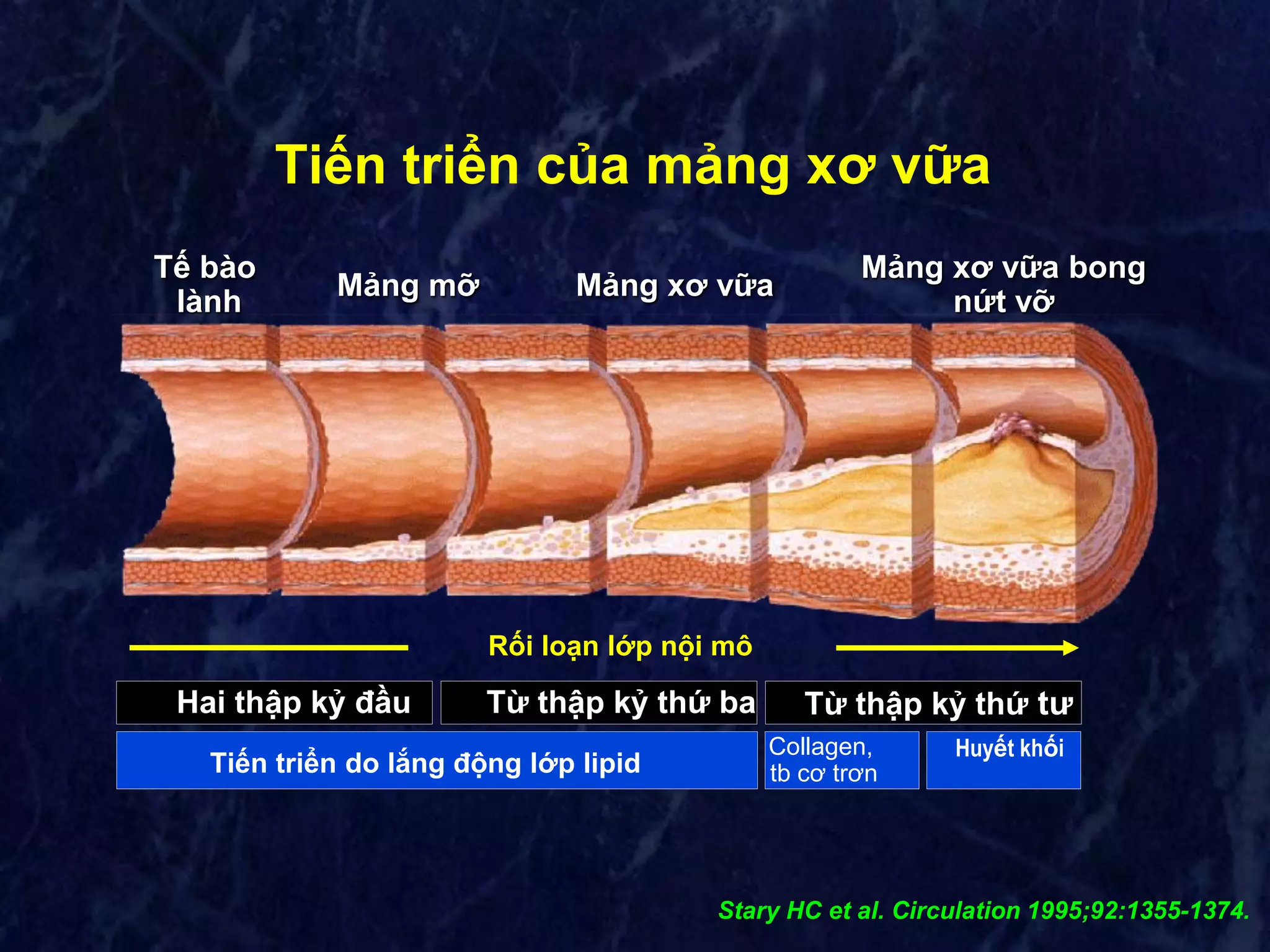 Dinh huynh-linh-xu-tri-dau-nguc | PDF