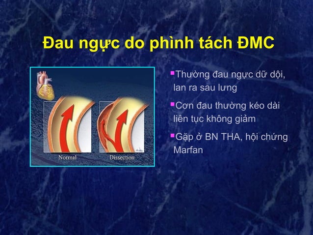 Dinh huynh-linh-xu-tri-dau-nguc | PPT