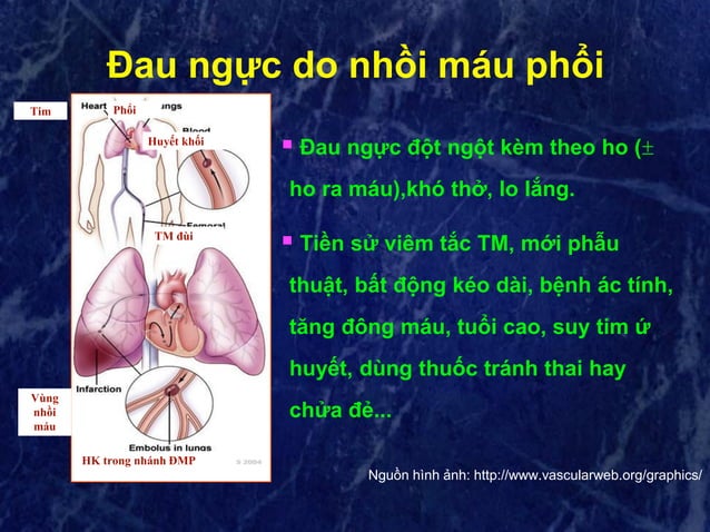 Dinh huynh-linh-xu-tri-dau-nguc | PPT