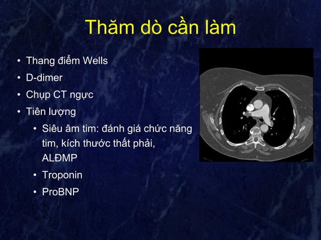 Dinh huynh-linh-xu-tri-dau-nguc | PPT