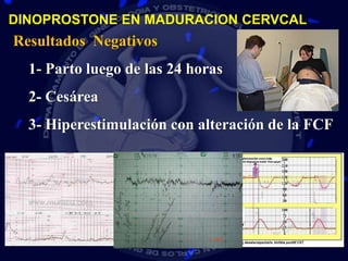 MADURACION CERVICAL CON DINOPROSTONA | PPTX
