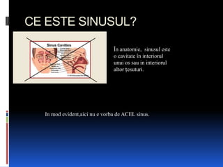 Dinu bianca x b | PPT