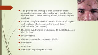 Diogenes syndrome | PPTX