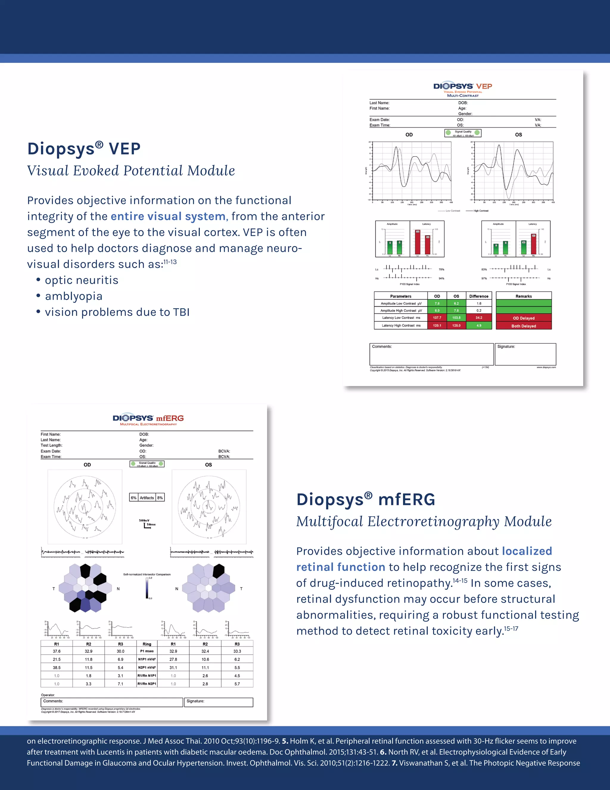 Diopsys Visual Electrophysiology Suite - Product Guide | PDF