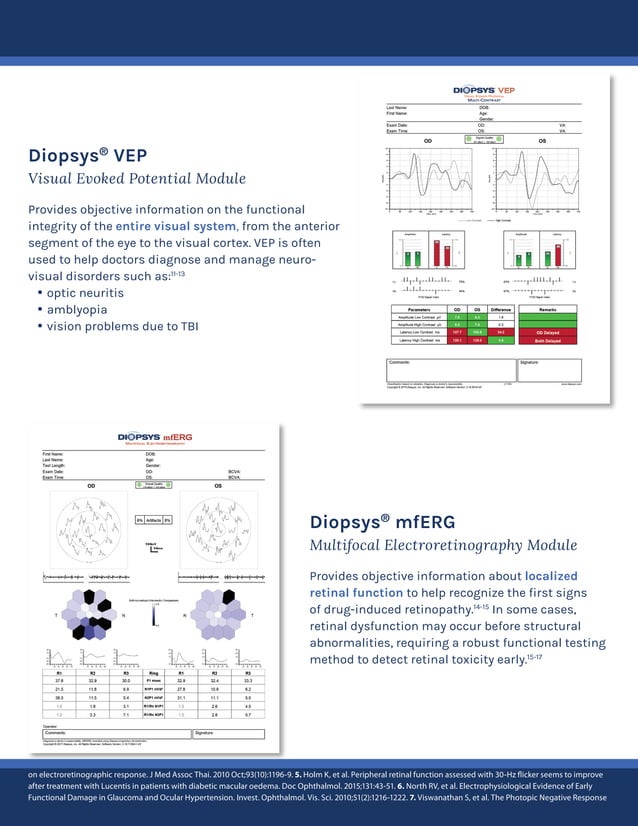 Diopsys Visual Electrophysiology Suite - Product Guide | PDF