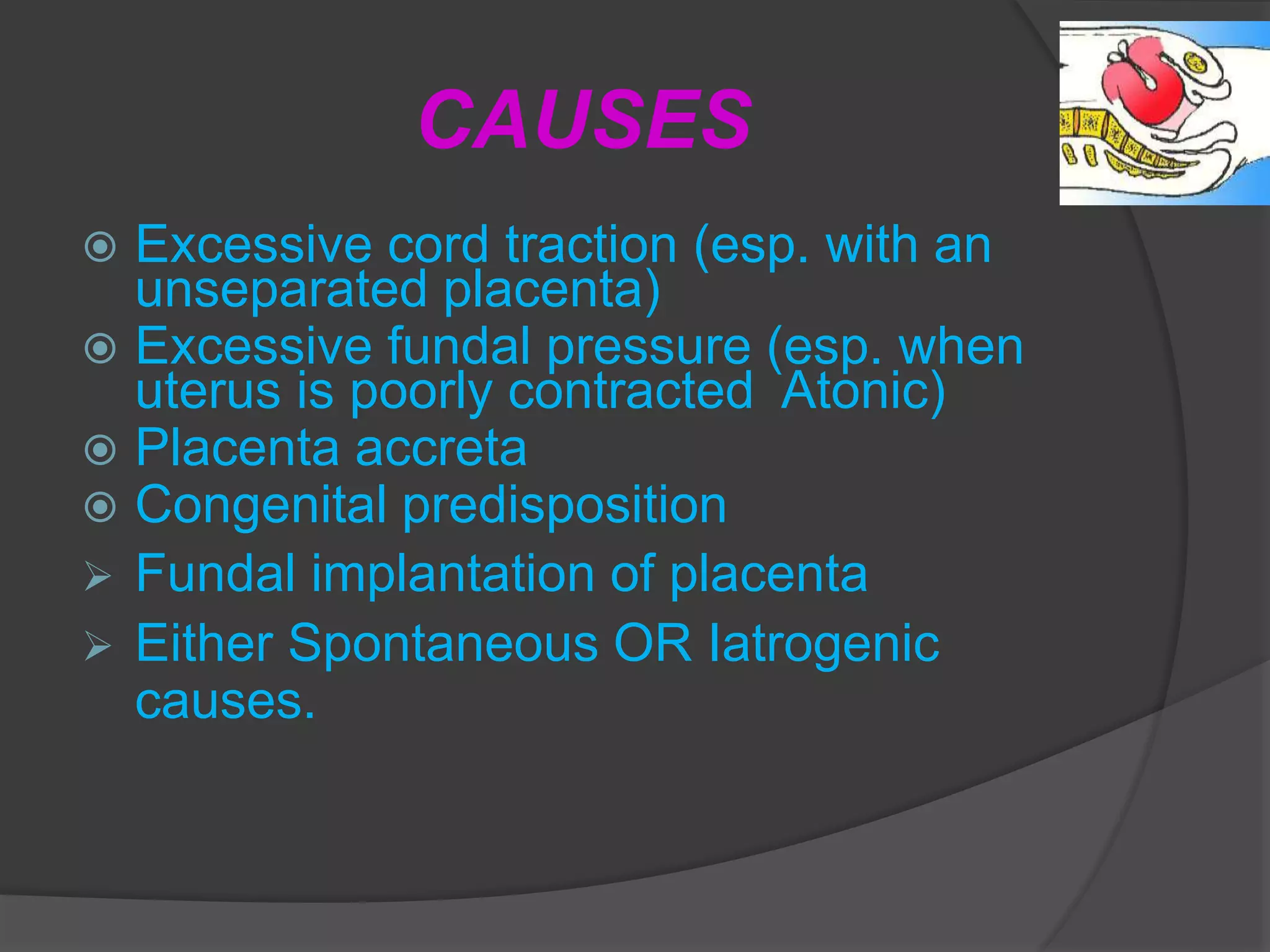 Inversion Of Uterus | PPTX