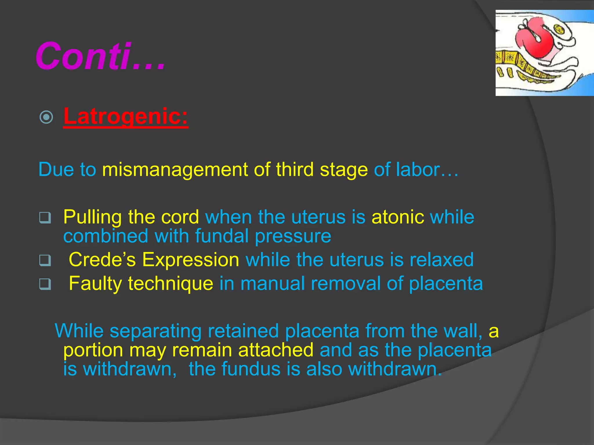 Inversion Of Uterus | PPTX