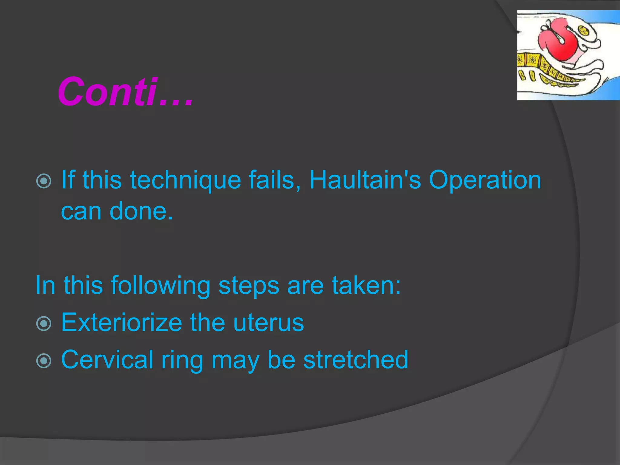 Inversion Of Uterus | PPTX