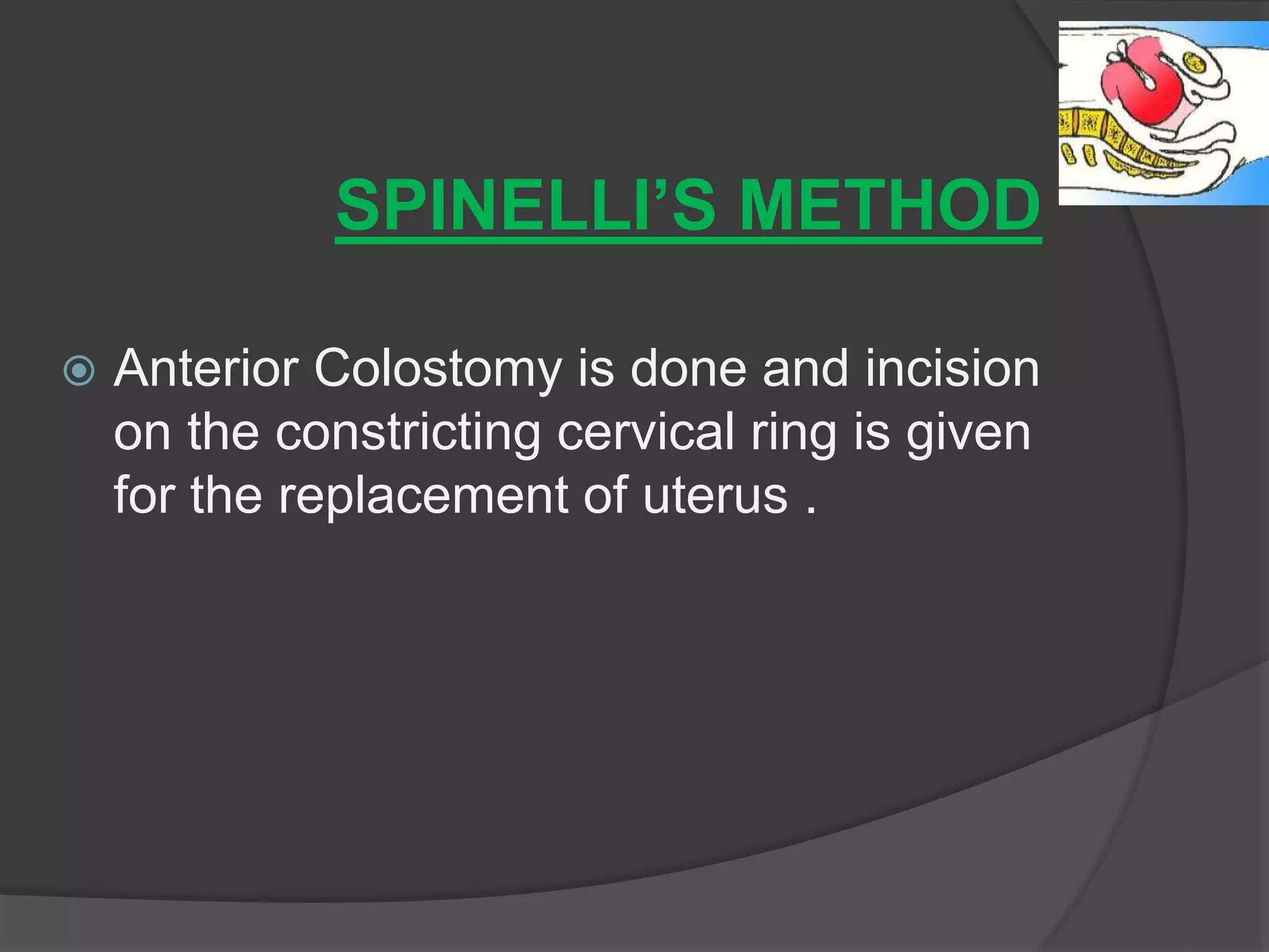 Inversion Of Uterus | PPTX