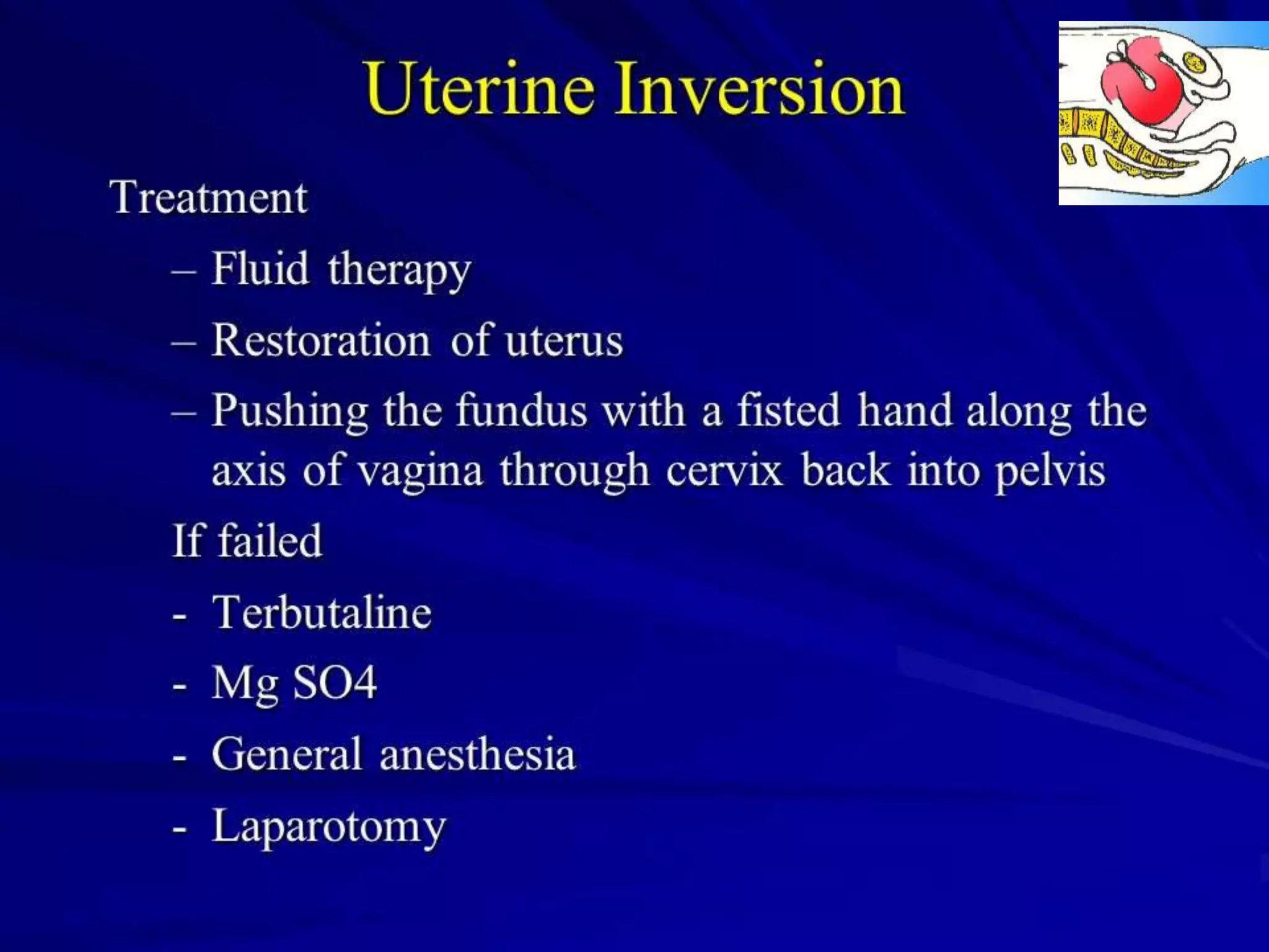 Inversion Of Uterus Ppt