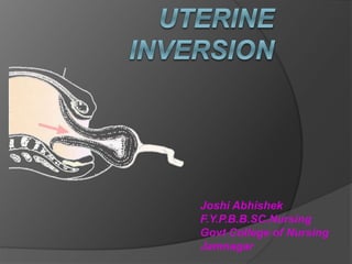 Inversion Of Uterus | PPTX