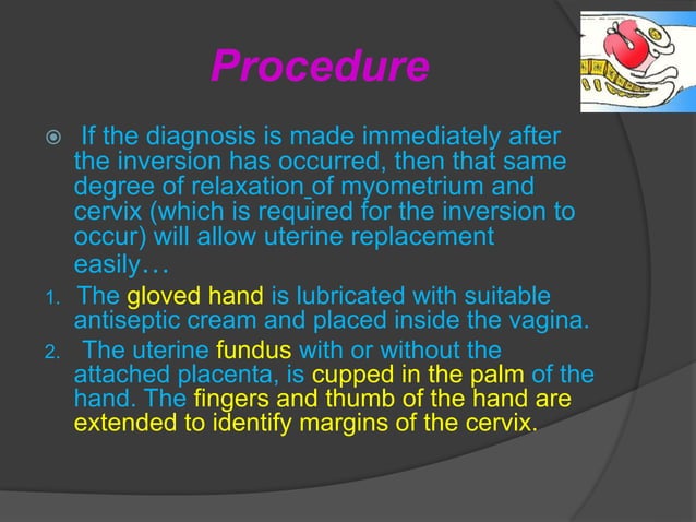 Inversion Of Uterus | PPTX | Pregnancy | Reproductive Health