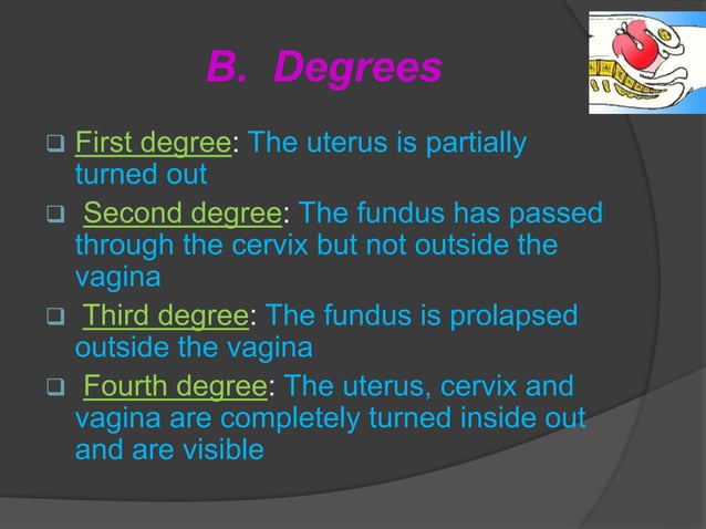 Inversion Of Uterus | PPTX | Pregnancy | Reproductive Health