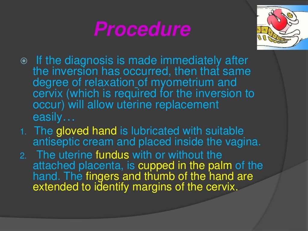 Inversion Of Uterus