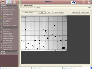 DIPA 2000 Particle Size & Shape Analyzer | PPSX