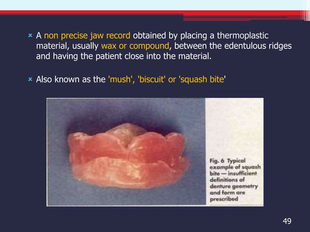 horizontal jaw relation in complete denture | PPTX