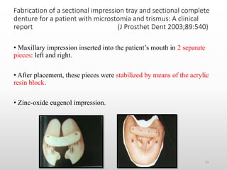 theories of impression making in complete denture | PPTX