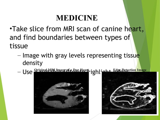 Digital Image Processing Dip Ppt Photo Editing Software Computer Software And Applications