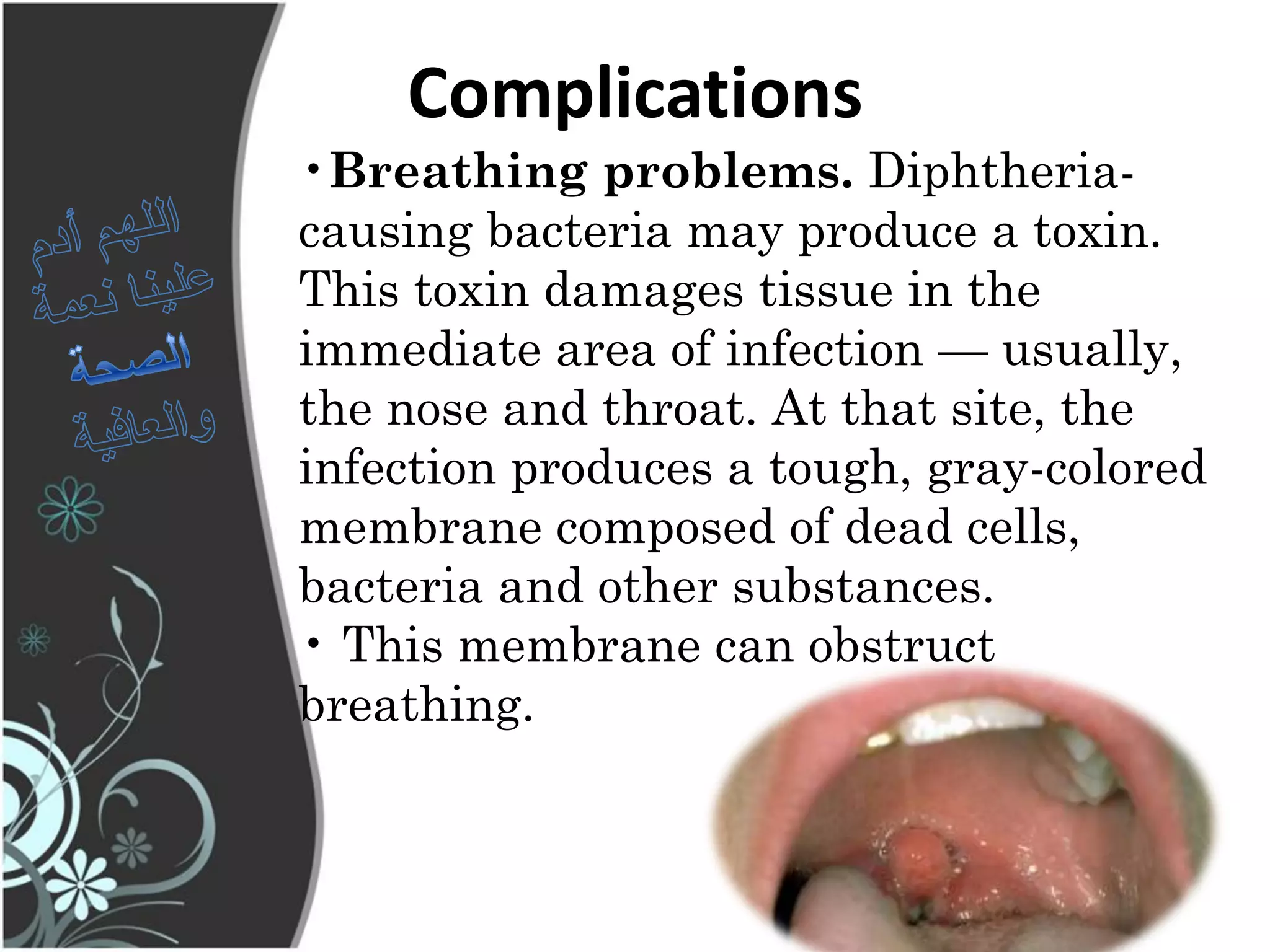 Diphtheria | PDF