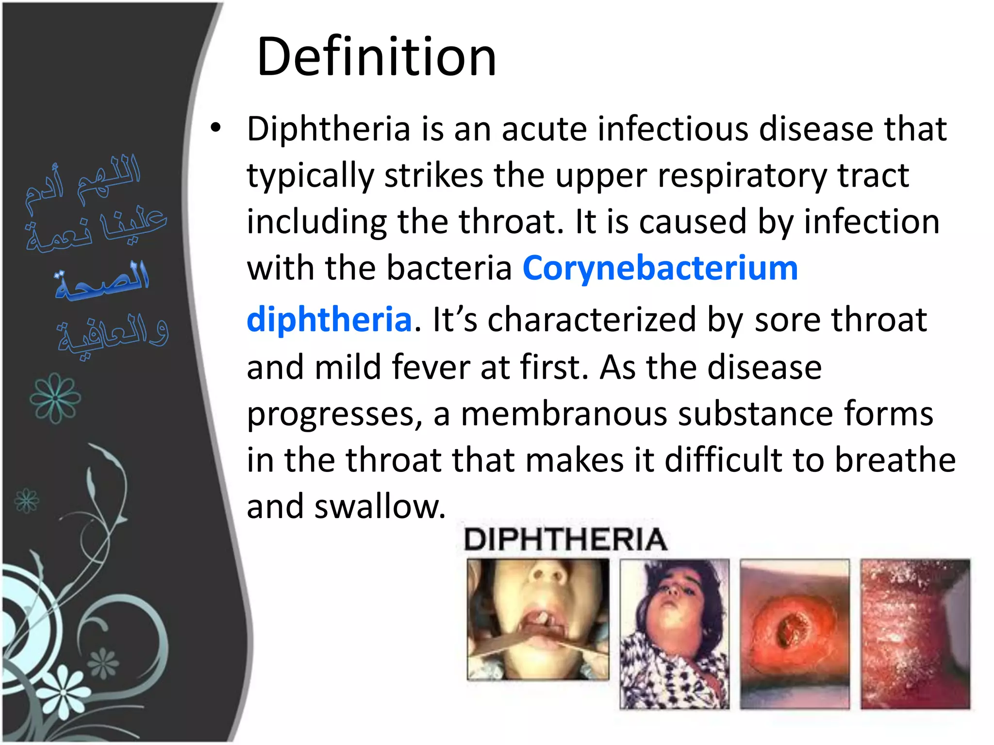 Diphtheria | PDF