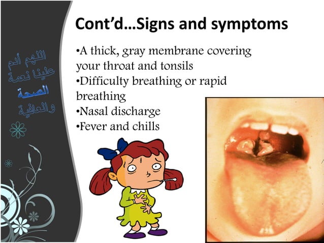 Diphtheria | PDF | Infectious Diseases | Diseases and Conditions