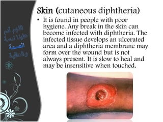 Cutaneous Diphtheria