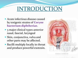 Diphtheria | PPTX