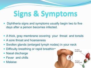 Diphtheria | PPTX | Infectious Diseases | Diseases and Conditions