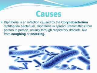Diphtheria | PPTX