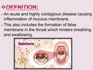Diphtheria Causes